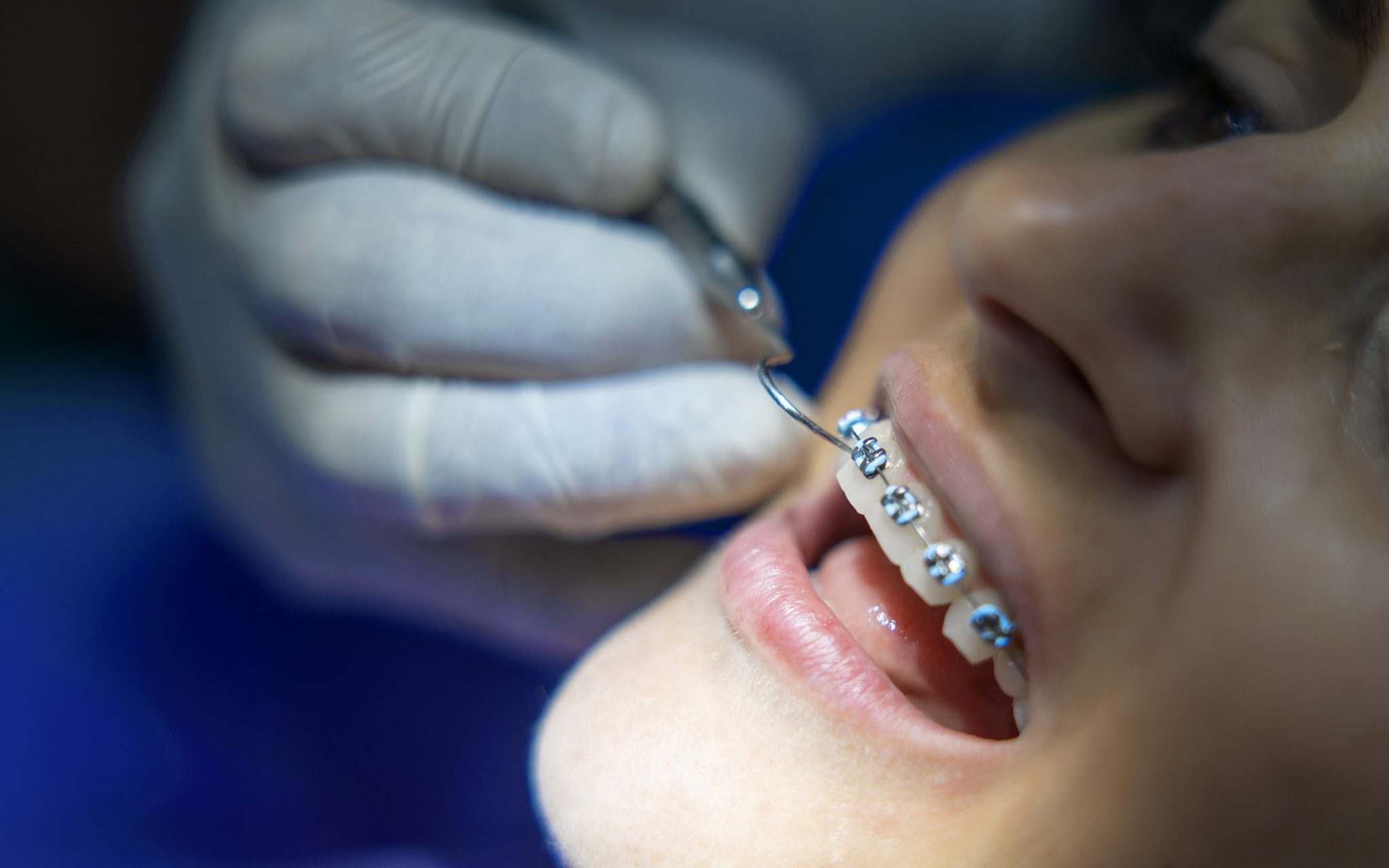 Orthodontist in Phoenix, AZ | Paradise Ridge Dentistry