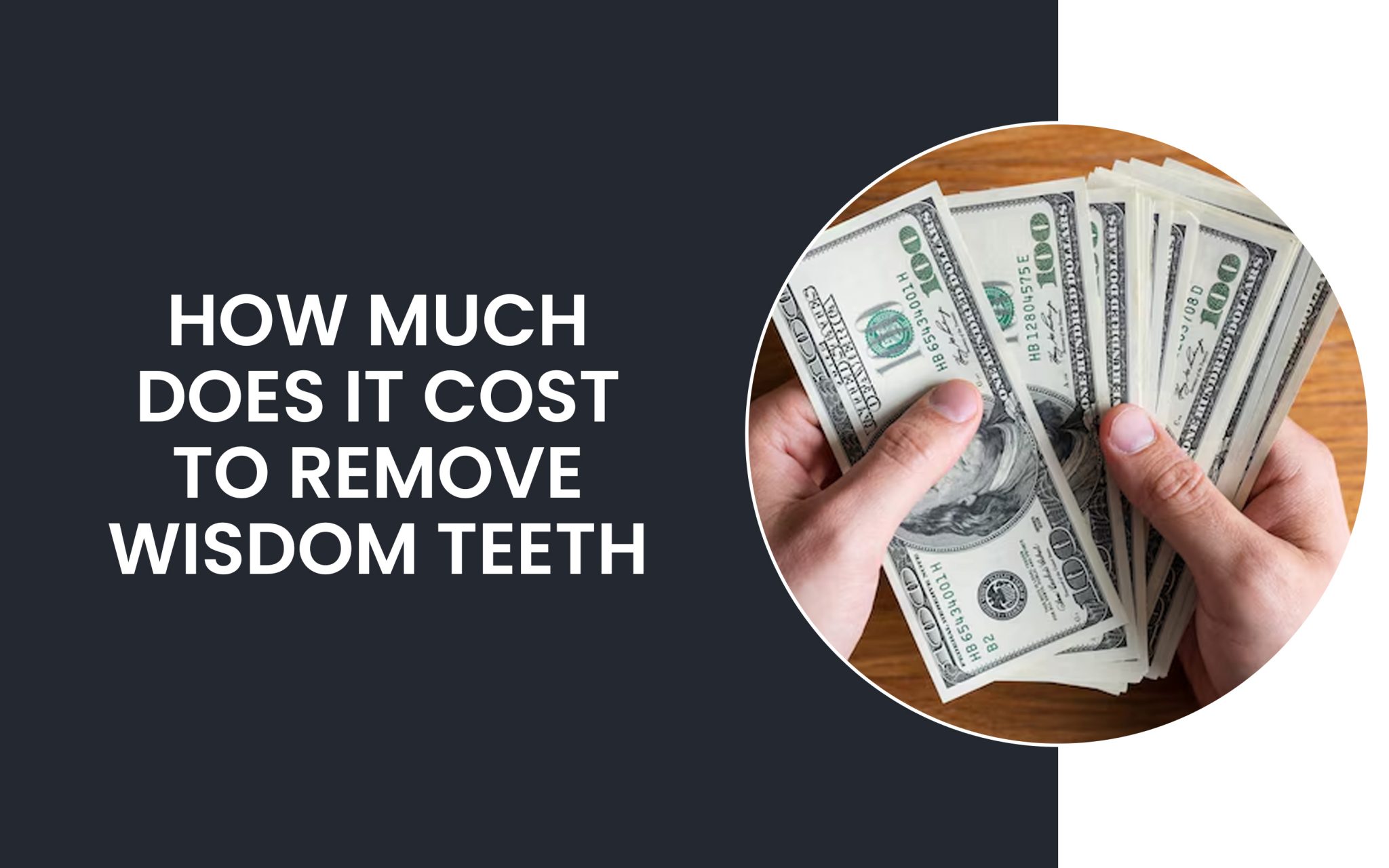 How Much Does It Cost To Remove Wisdom Teeth